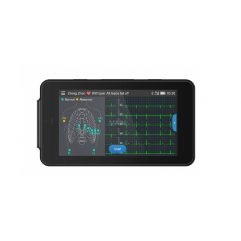Electrocardiographe 12 dérivations portable Pocket - ECG 500 Lepu Medical
